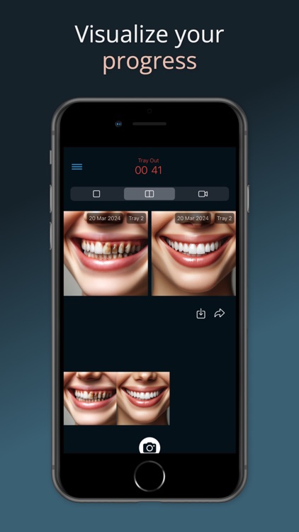 AlignMate - Aligner Tracker by Allan Korir