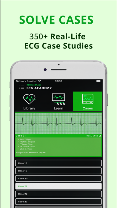 ECG Academy - Learn EKG Skills for iPhone - Free App Download ECG Academy - Learn EKG Skills for iPhone - Free App Download