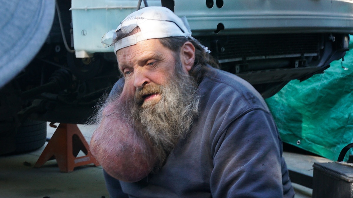 ‎The Man With the Talking Neck Tumor - Take My Tumor (Series 1, Episode ...