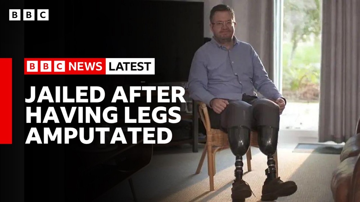 ‎Surgeon Jailed After Amputation Of Own Legs - Apple TV