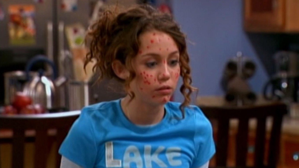 Ooo, Ooo, Itchy Woman - Hannah Montana (Series 1, Episode 9) - Apple TV ...