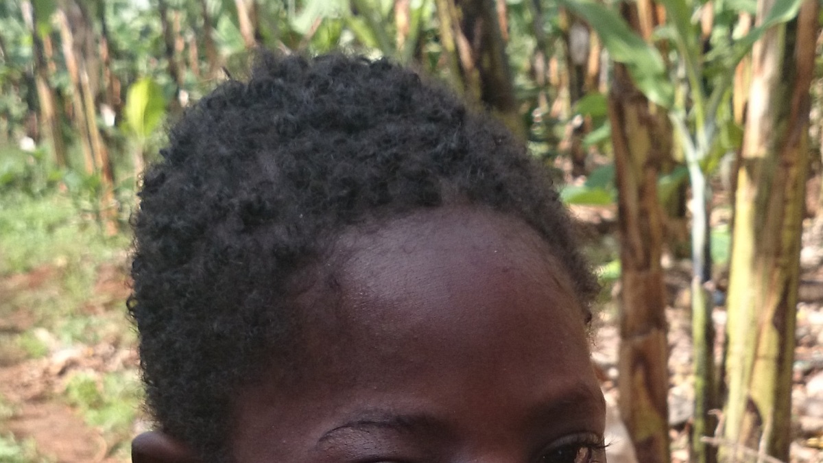 ‎Erick: The Boy With No Face - A Year On - Apple TV