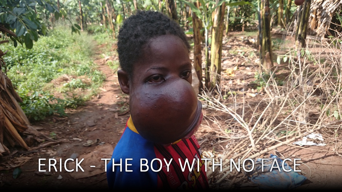 ‎Erick: The Boy With No Face - Apple TV