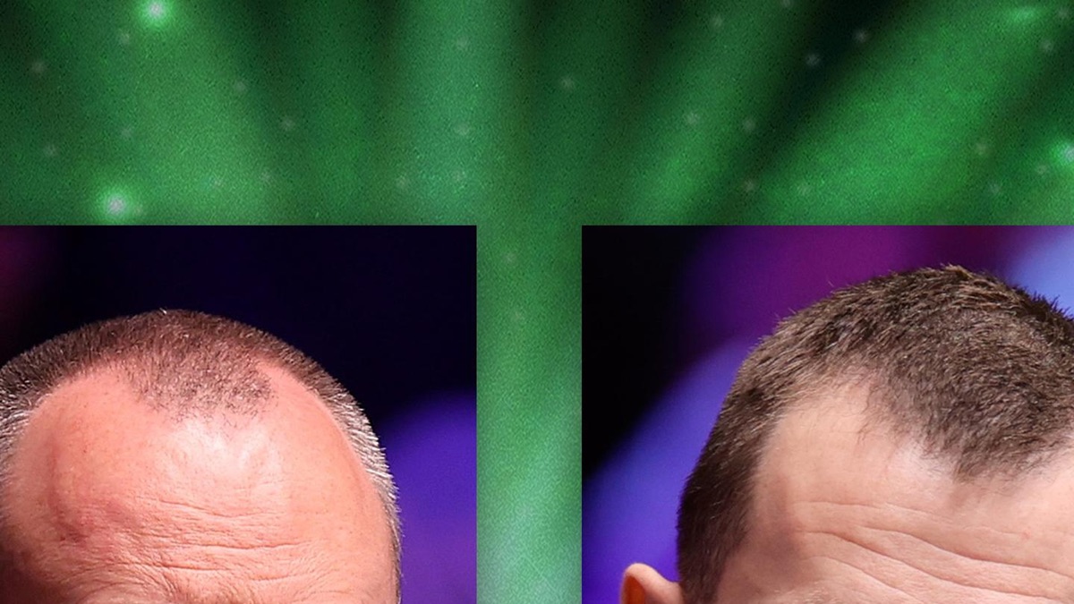 ‎Mark Williams - Mark Allen - Apple TV