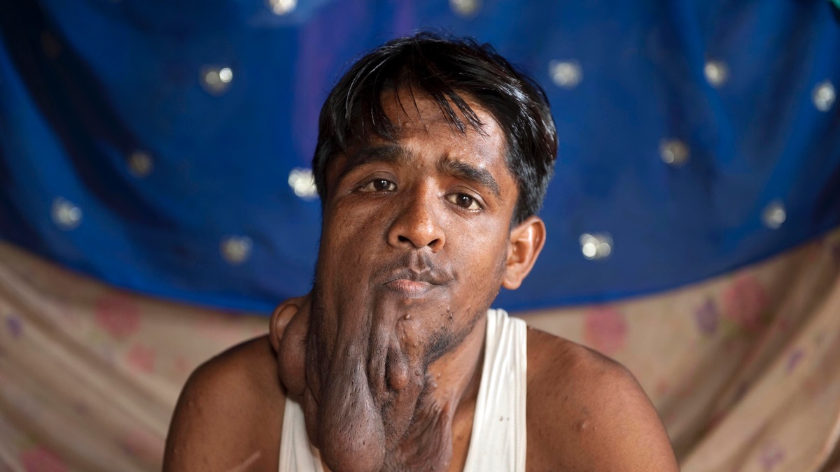 ‎My Face Won't Stop Growing - Body Bizarre (Series 4, Episode 2 ...