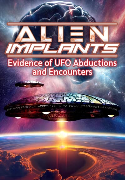 ‎Alien Implants: Evidence of UFO Abductions and Encounters - Apple TV
