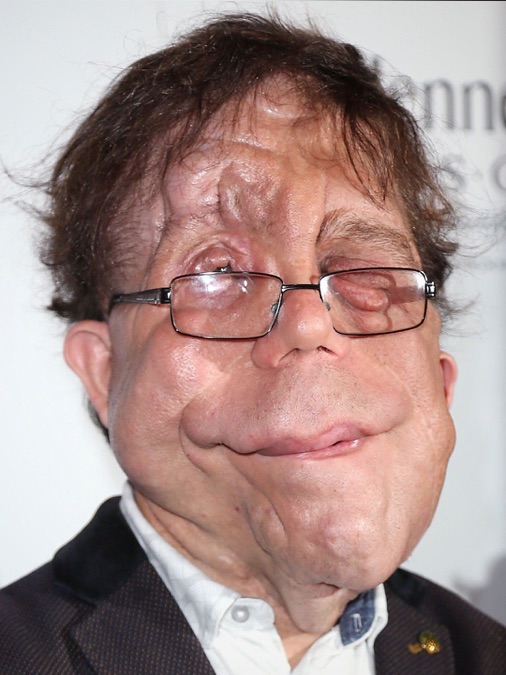 Adam Pearson Movies and Shows - Apple TV