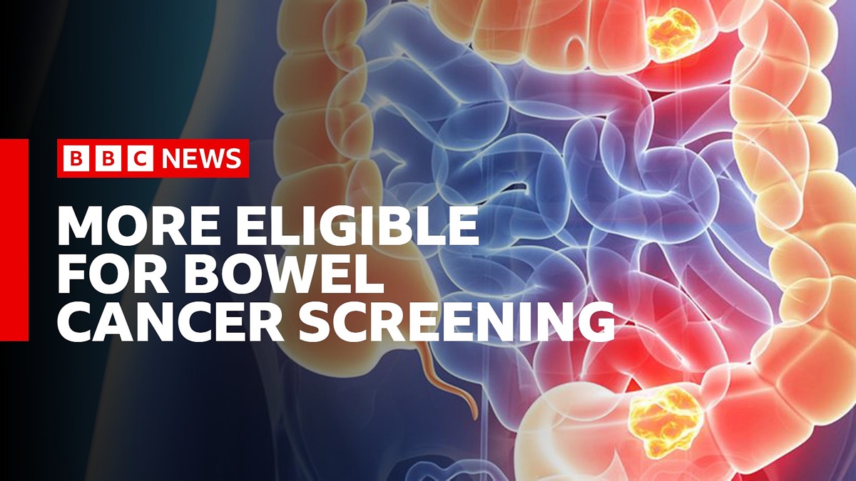‎New Rules on Bowel Cancer Screening - Apple TV