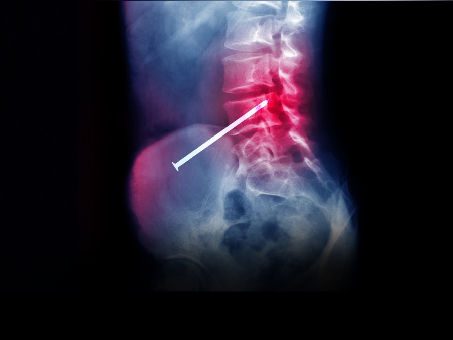 I Was Impaled - Apple TV