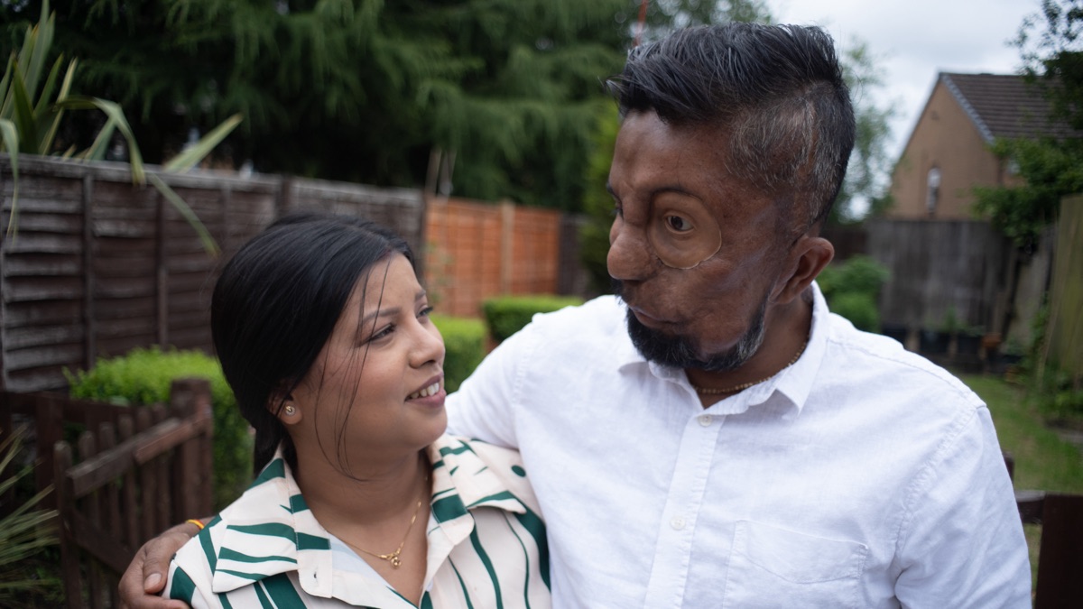 Tumors Forced My Eye Out - Body Bizarre (Series 8, Episode 3) - Apple ...