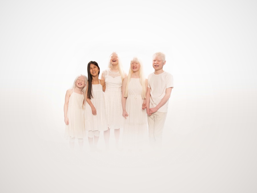 Born With Albinism - Apple TV (CA)